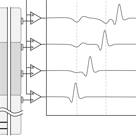 Biphasic Pulses Of Different Waveforms A Rectangular B Sinusoidal