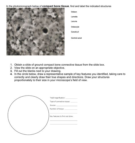 Bone Tissue Labeled
