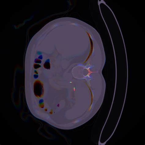 lesion detection object detection dataset by lesion