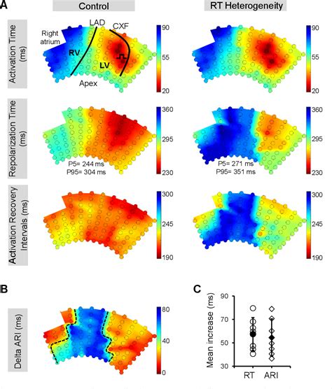 Figure 1 From Critical Repolarization Gradients Determine The Induction