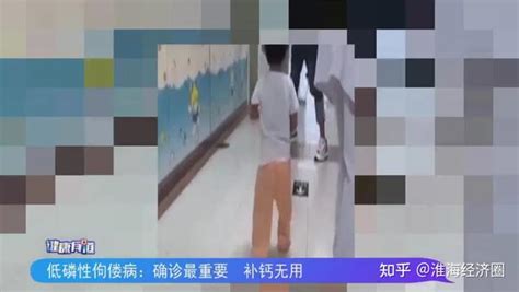 低磷性佝偻病：确诊最重要 补钙无用 知乎