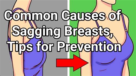 Common Causes Of Sagging Breasts And Tips For Prevention Youtube
