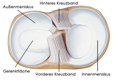 Meniskusriss Ursachen Symptome Diagnose Behandlungen
