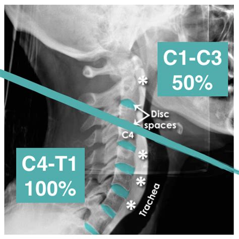 Soft Tissue Neck X Ray Anatomy