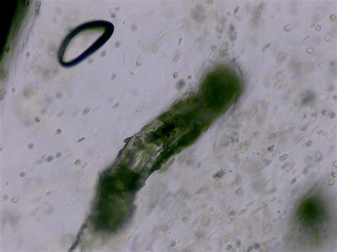 At 2500x The Mucus Ball That Formed In My Throat Has A Chaetogaster In