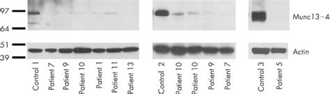 Munc13 4 Protein Expression Is Greatly Reduced Or Absent In Many Cells Download Scientific