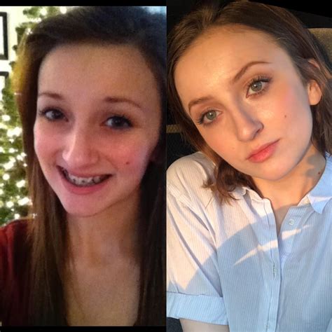2011 Vs 2018 High School Was A Dark Time For My Eyebrows P R
