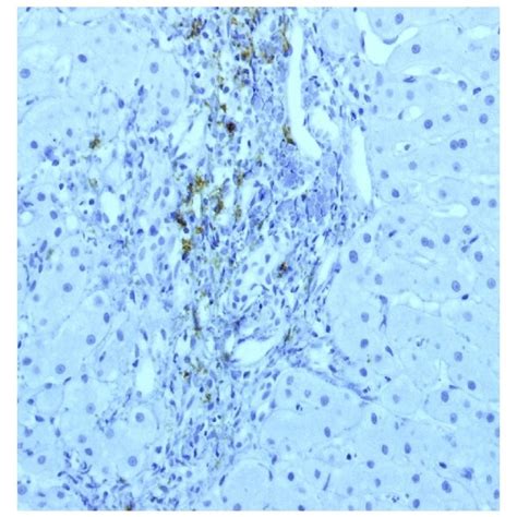 Representative Microphotographs Of Cd20 Marker By Immunohistochemistry