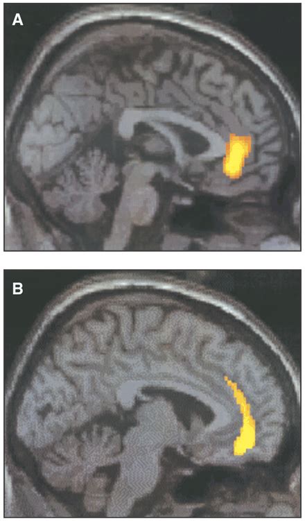 Will Anterior Cingulate Cortex And Addiction Science