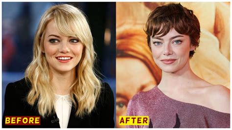 Emma Stone 2025 New Face Rumors Before And After Photos And The Truth