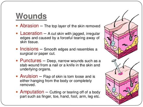 First Aid Ppt