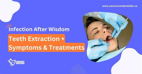 Infection After Wisdom Teeth Extraction Symptoms And Treatments