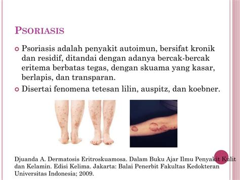 Ppt Presentasi Kasus Dermatitis Numularis Powerpoint Presentation