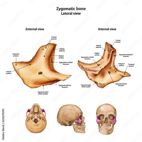 Zygomatic Bone