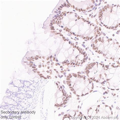 Anti Cdk12 Antibody Epr29009 30 Ab317746 Abcam