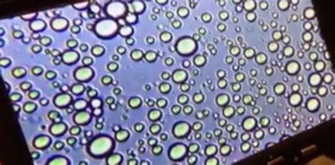 Mum Who Put Breastmilk Under A Microscope Interview