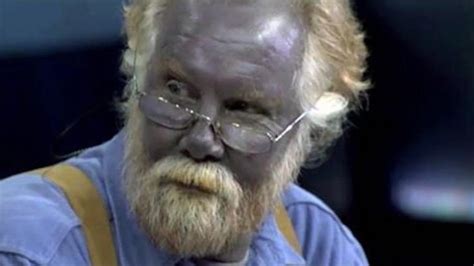 La Aciaga Historia Del Hombre Que Se Volvió Azul El Papá Pitufo De