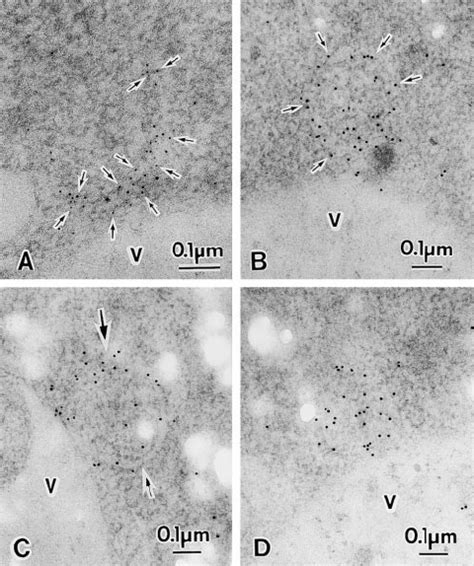 Possible Intermediate Structures Of Autophagosome A A Membrane Sac