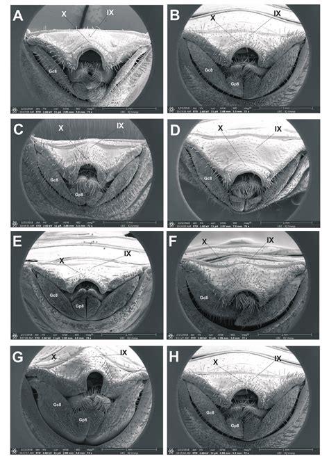Female External Genitalia By Sem N Confusa Sp N A Schizothorax An Female External Genitalia By Sem N Confusa Sp N A Schizothorax An
