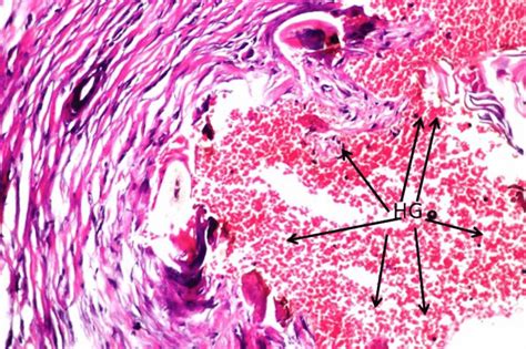 The Skin Of The Dog Of The Control Group Showing Granulation Tissue