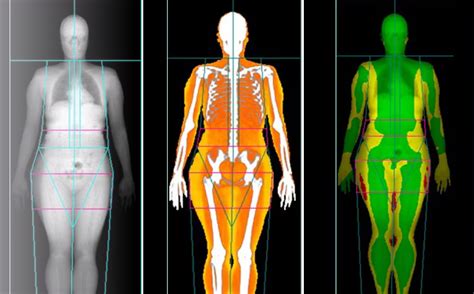 Body Composition Testing In Lee Nh Breast Center Of New England