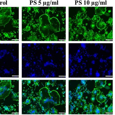 Effect Of The Ps On Ranklinduced F Actin Ring Formation Raw 2647