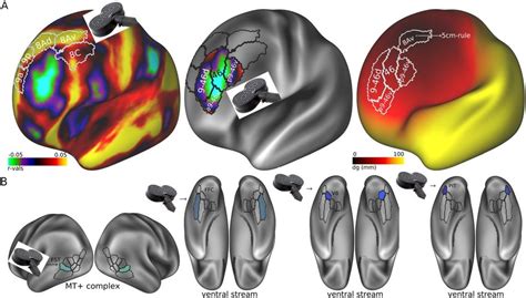 Dlpfc Pos Versus Dlpfc Neg And Potential Targets For Tms A From Download Scientific Diagram
