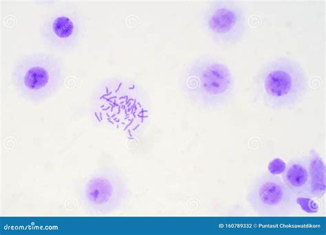 Condensed Chromosomes Can Be Seen Under A Microscope During At Blanca