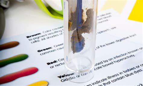 Exámenes De Heces En Panamá America Lab