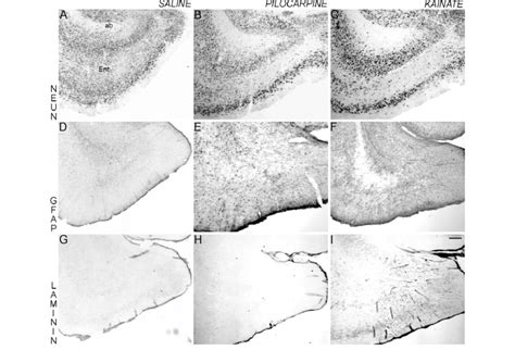 Photomicrographs Illustrating Localization Of Lesions In The Entorhinal