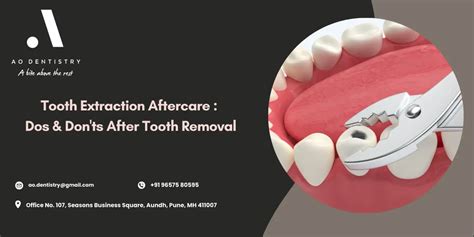 Tooth Extraction Aftercare Dos And Donts After Tooth Removal Ao