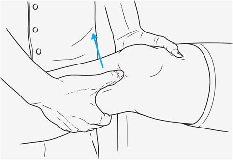 Using The Lachmans Test To Assess Acl Stability Human Kinetics Canada