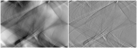 Crazybiocomputing Learning Tomography Weighted Back Projection