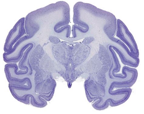 Frontal Section Through Telencephalon And Diencephalon Diagram Quizlet