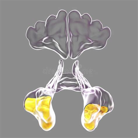 Diffuse Maxillary Sinusitis Stock Illustrations 5 Diffuse Maxillary Sinusitis Stock