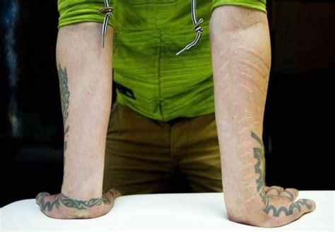 Scarification The Extreme Body Art Thats Making A Mark The Globe