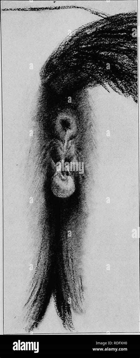 The Best 17 Persona Hermafroditismo En Seres Humanos