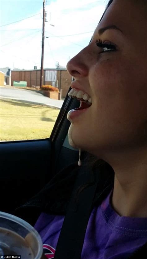 Woman Tries A Milkshake After Surgery On Her Wisdom Teeth And It Goes Horribly Wrong Daily