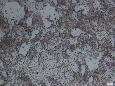 Cytopathic Effect Caused By Bpiv3 Virus And Haemadsorption Of Download Scientific Diagram