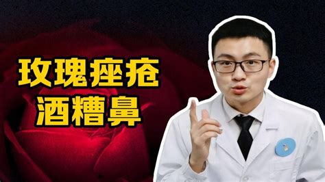 你以为酒糟鼻离你很远？其实很多人都受过玫瑰痤疮的伤！ Youtube