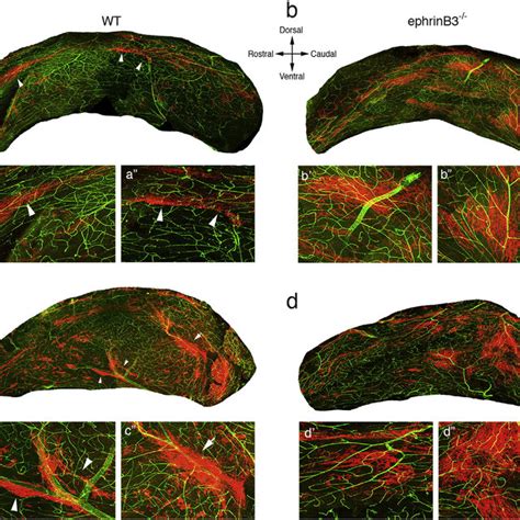 A Stylized View Of The Normal Subventricular Zone Svz Neural Stem