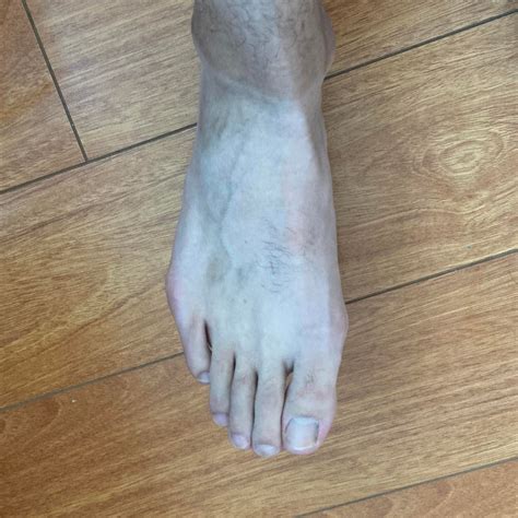 243 Best R Footfunction Images On Pholder Relaxed Vs On The Ground