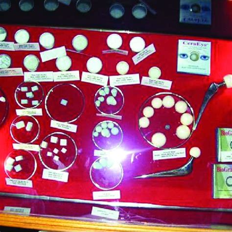 Composition Of Bioglass And Glass Ceramics Download Scientific Diagram