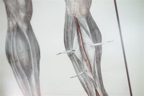 The Anatomy And Histology Of Condyloid Joints