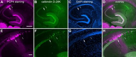 Distinct Physiological And Developmental Properties Of Hippocampal Ca2 Subfield Revealed By
