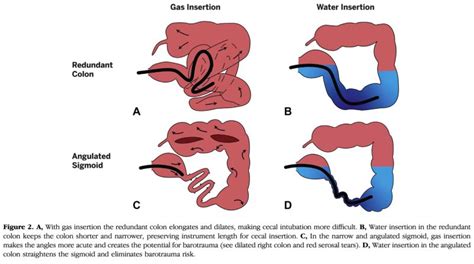 Muhammad Bilal Awan Posted On Linkedin