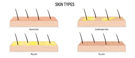 Skin Types Vector Different Types Of Skin Problems Normal Combination