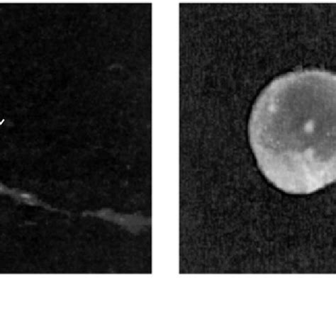 Immunochemical Staining Of Cultured Isolated Command Interneurons With