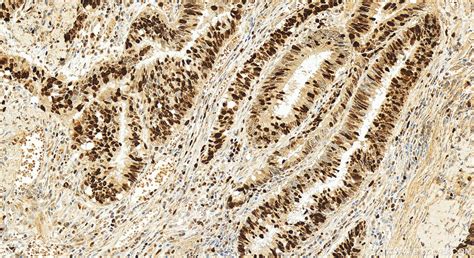 Ki 67 Antibody 32270 1 Ap Proteintech