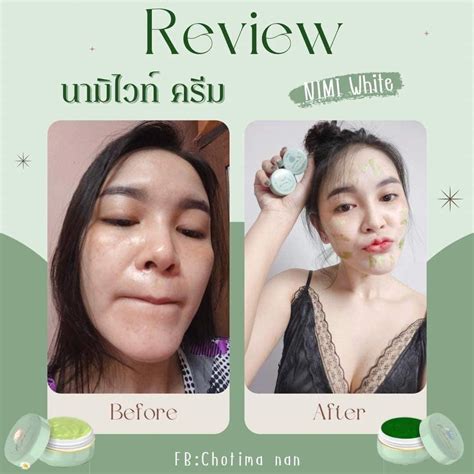 ครีมชบา ชบา ครีมชบา ชบา เซรั่มมิรา รายใหญ่กรุงเทพ